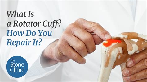 Recovery Time For Rotator Cuff Surgery