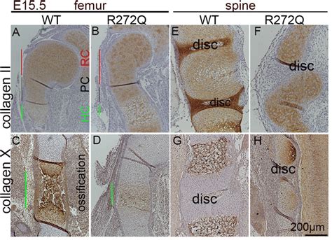 Loss Of Ick Functions Significantly Alters Chondrocyte Differentiation