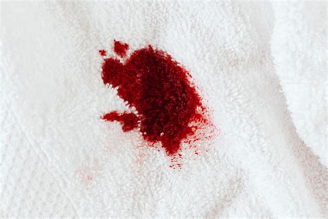 أسباب نزول دم أثناء العلاقة الزوجية بدون ألم ايجي كلينك