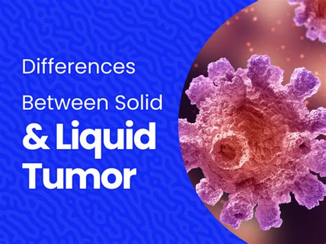 What Are The Differences Between Solid And Liquid Tumors Massive Bio