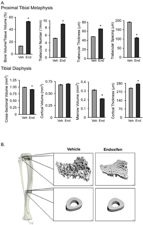 Micro Ct Analysis Of The Tibia In Ovariectomized Mice Following 45 Days