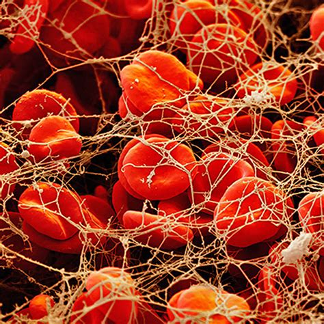Blood Coagulation Factors Coagulation Cascade Test And Coagulation Defect