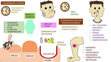 La Historia De La Leishmaniasis Una Enfermedad Milenaria
