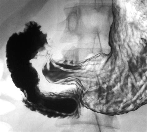 Pin On Radiology Signs