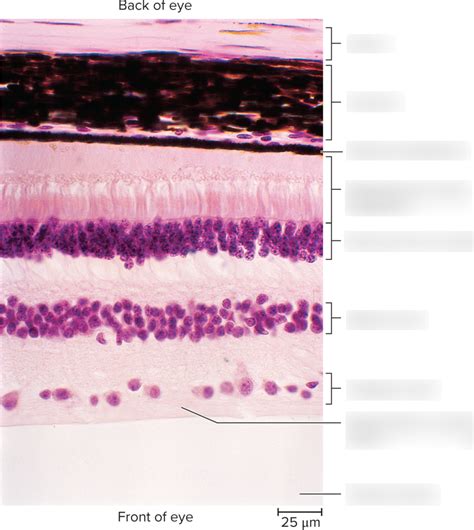 Retina Practical Exam Diagram Quizlet