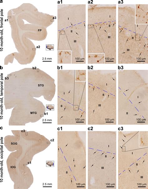 Dcx Neuronal Profiles In The Neocortex Of The Frontal Temporal And Download Scientific