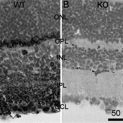 C Terminal Binding Protein 2 Ctbp2 Immunostaining At Ribbons Is Download Scientific Diagram