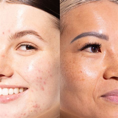 Skin Type 4 Collections Renée Rouleau Professional Skin Care