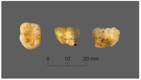 Tooth Enamel Surface Topography At Nora Weeks Blog