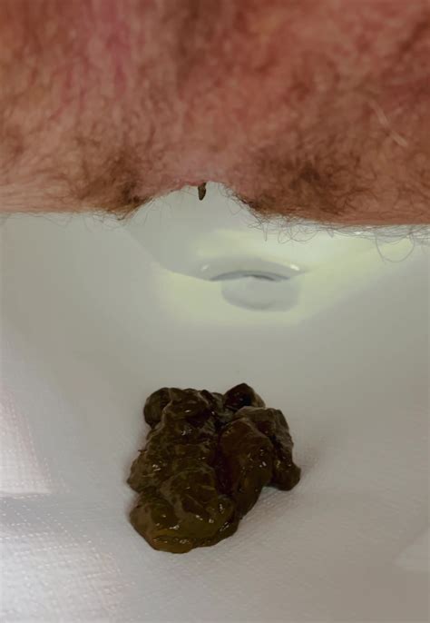 This Is The Second Flush After A Big Liquid Diarrhea