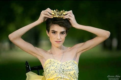 Delarize Verloor Haar Dapper Stryd Teen Kanker Springs Advertiser