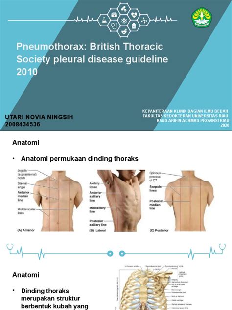 Pneumothorax Bts Pdf