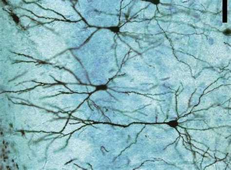 Neuronal Diversity News Research Tags Articles Neuroscience News