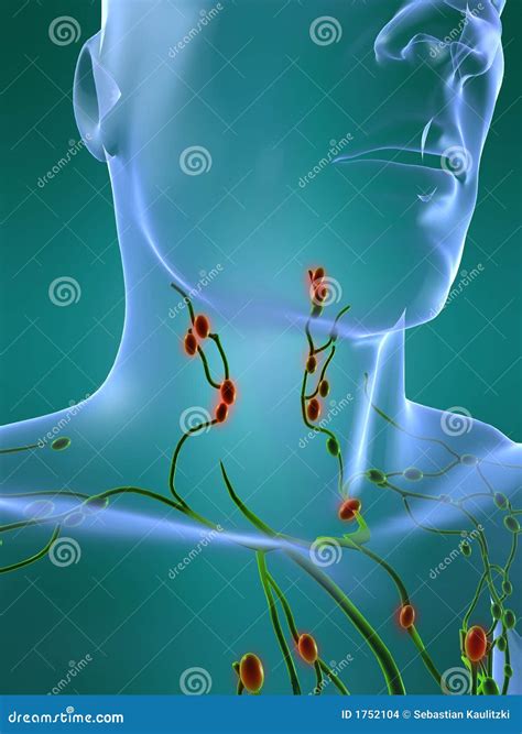 Swollen Lymphnodes Stock Images Image 1752104
