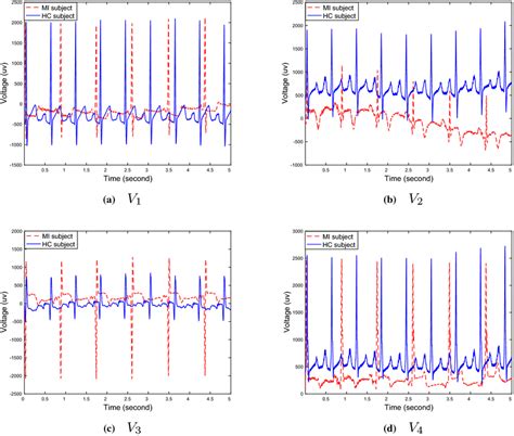 Examples Of The Synthesis Of 4 Dimensional Cardiac Vector