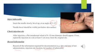 Tuberculin Skin Test Tst Mantoux Test Pdf