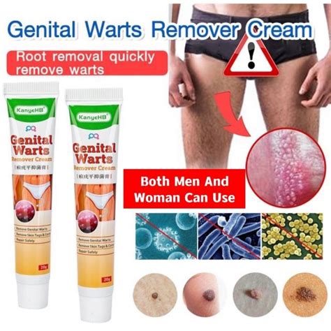 Genital Warts Remover Ointment Herpes Condyloma Care Acne Treatment