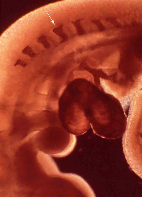 Mouse Embryo Photograph By Science Photo Library Pixels Merch