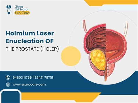 Holmium Laser Enucleation Of The Prostate Holep What You Need To Know
