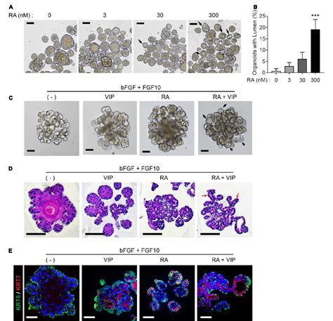 Parotid Gland Tissue Type At Eva Howse Blog