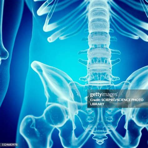 Lumbar Spine X Ray Photos And Premium High Res Pictures Getty Images