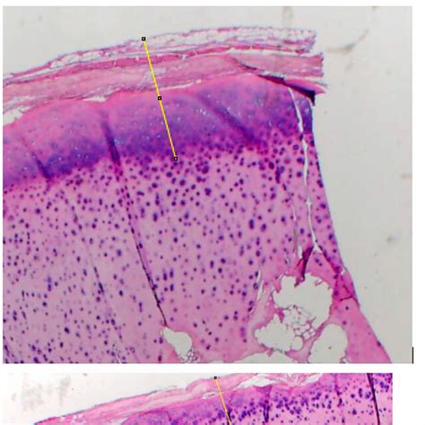 Specimen Diameters Showing Superficial To Germinal Basal Layer