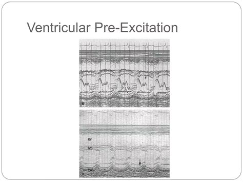 Lv Systolic Functionpptx