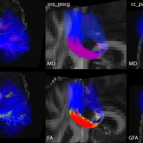 Corrected P Values Projected Onto The P Bundles Showing Regions With Download Scientific