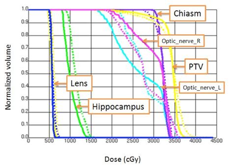 A Treatment Planning Class Solution For Hipppocampal Avoidance Whole