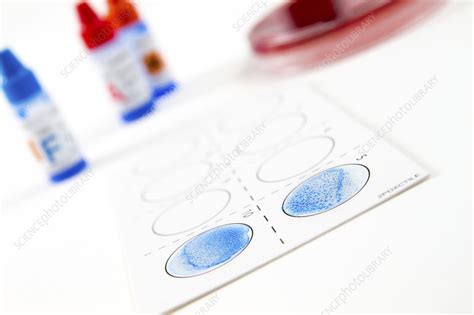 Streptococcal Grouping Test Stock Image C0291359 Science Photo