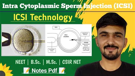 Icsi Technology Intra Cytoplasmic Sperm Injection By Dadhich Sir Youtube