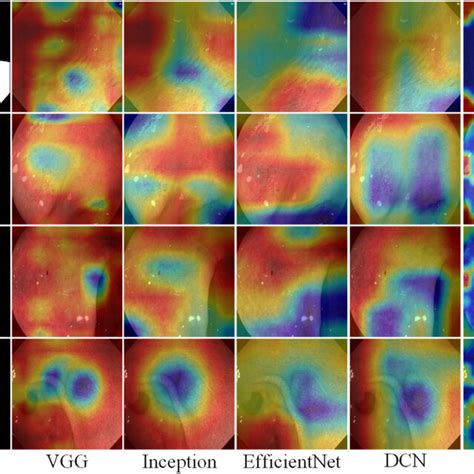 Eigen Cam Visualization Results Of Different Method Focus Areas Mask Download Scientific