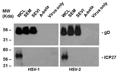 Amyloid Virus Binding Assay Left 1 Ml Of Hsv 1 10 7 Ml Was Download Scientific Diagram