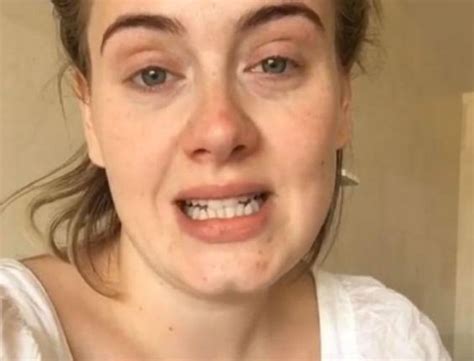 Sick Looking Adele Apologizes To Fans After Cancelling Concert Due To Illness Photos Video