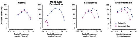 Amblyopia Clinical Tree