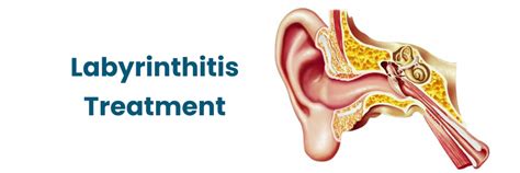 Labyrinthitis Treatment