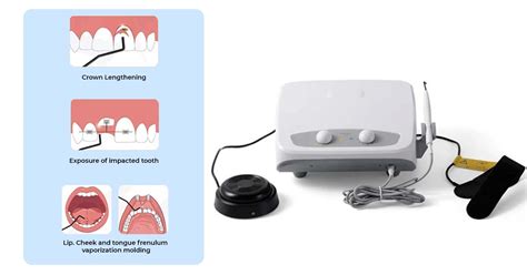 Electrosurgery In Dentistry Techniques Benefits And Best Practices