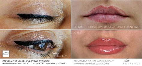 When Permanent Makeup Goes Wrong Mw Aesthetics