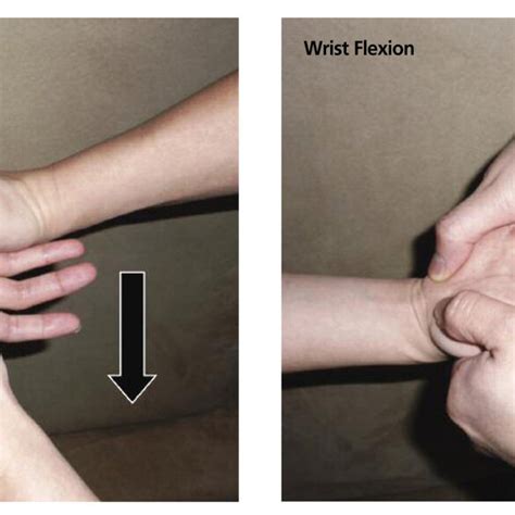The Physician Induces Radial Deviation Lateral Abduction And Ulnar