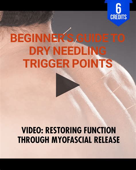 Beginners Guide To Dry Needling Trigger Points Restoring Function Th