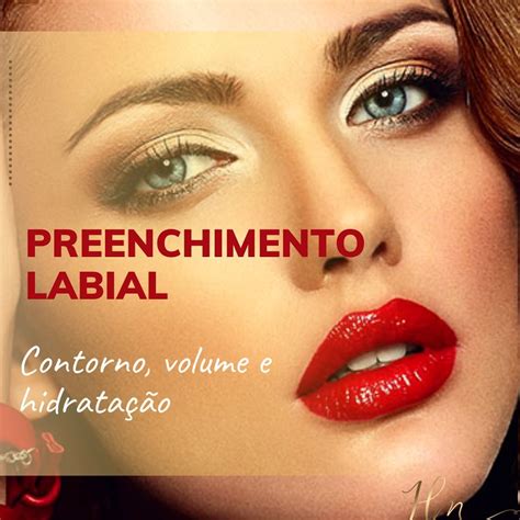 🦋 O Preenchimento é Feito Com ácido Hellen Marin Saúde