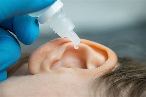 Is It Safe To Put Hydrogen Peroxide In Your Ear Miracle Ear