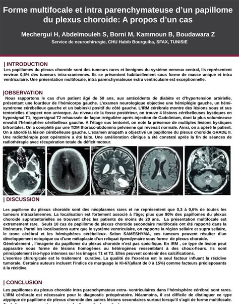 Pdf Forme Multifocale Et Intra Parenchymateuse Dun Papillome Du Plexus Choroïde à Propos D