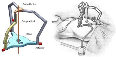 Fully Decoupled 4 Dof Rcm Parallel Manipulator Download Scientific Diagram