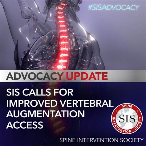 Vertebral Augmentation Is One Of The Most Gratifying Procedures As