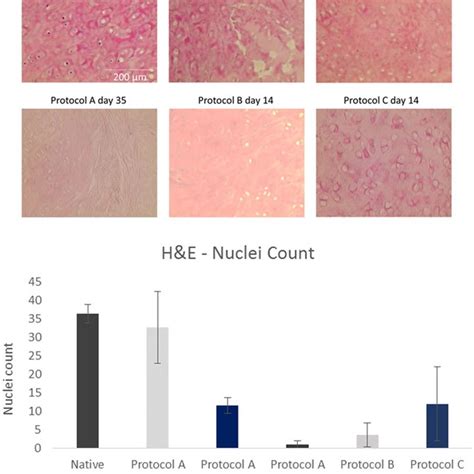 Hande Stained Cartilage Sections Demonstrating Decellularization Of