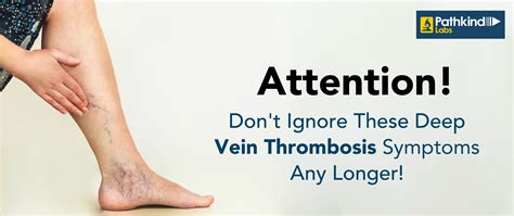 What Is Thrombosis Symptoms Deep Vein Thrombosis Causes Symptoms