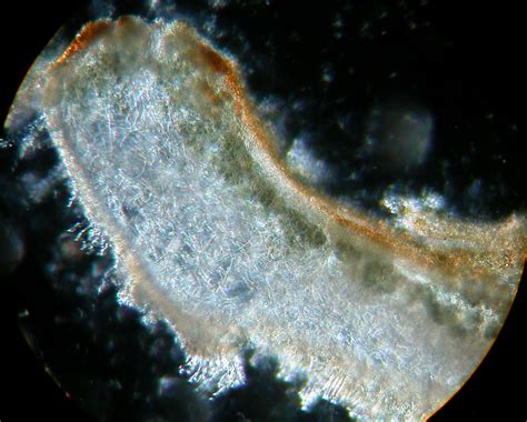 Cortex Lichens Of The Evergreen State College