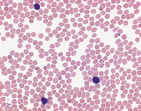 May Grünwalds Eosine Methylene Blue Solution Modified For Microscopy