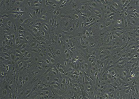 人脐静脉血管内皮细胞 Huvec金少源上海生物科技有限公司